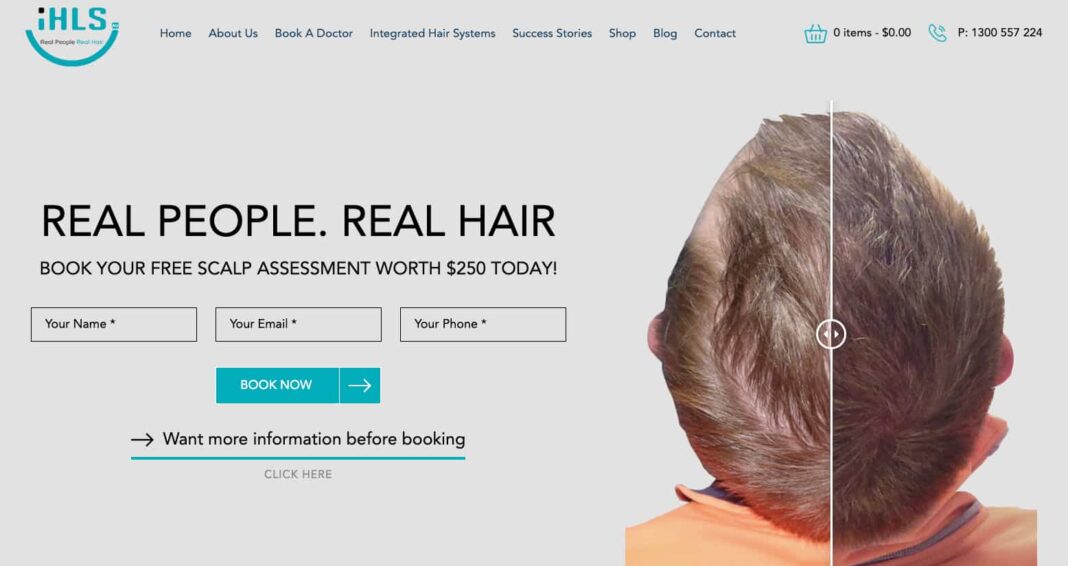 Top 10 Hair Transplant Clinics in Perth (2025)