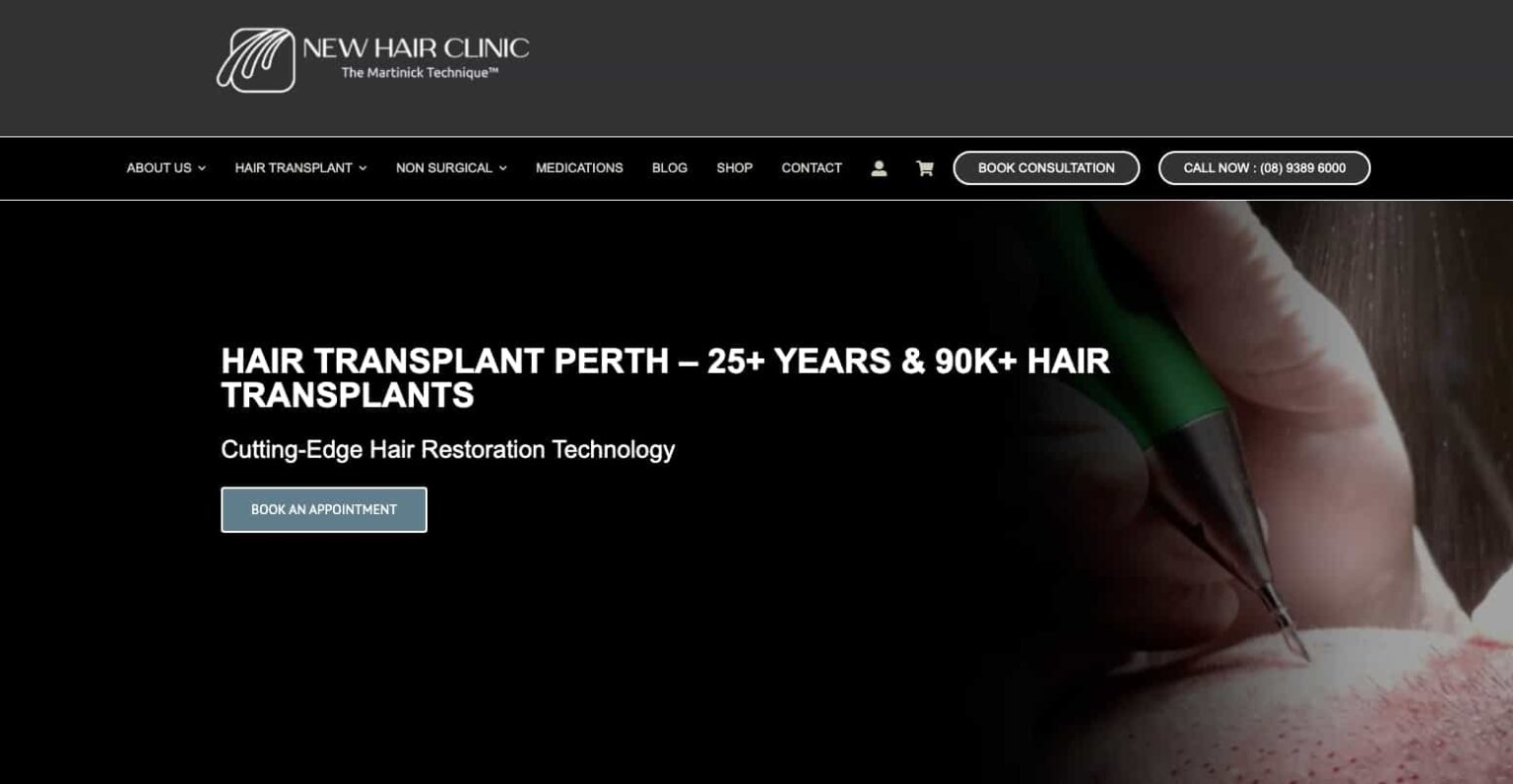 Top 10 Hair Transplant Clinics in Perth (2025)